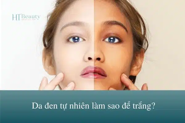 12 CÁCH DA ĐEN TỰ NHIÊN LÀM SAO ĐỂ TRẮNG CHỈ 30 PHÚT/ NGÀY